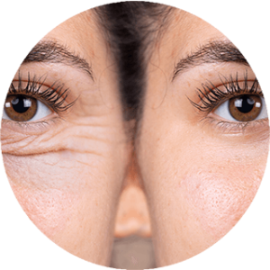 Oculofacial Plastics | New York Ophthalmology